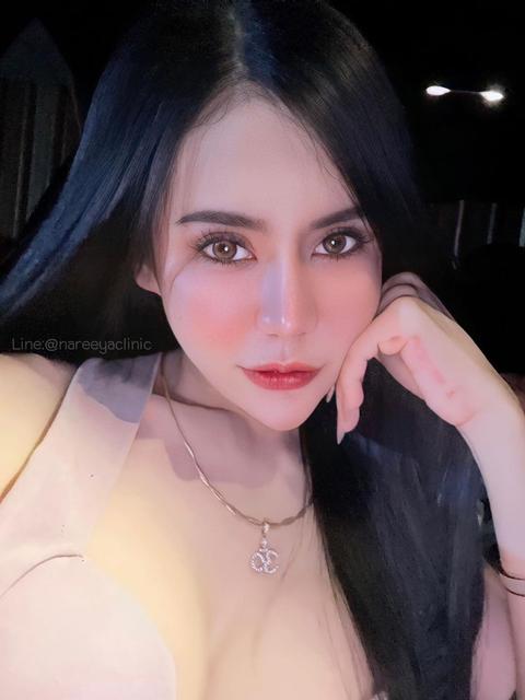 แก้มเยอะ แก้มห้อย ใบหน้าไม่ได้รูป | ENNXO